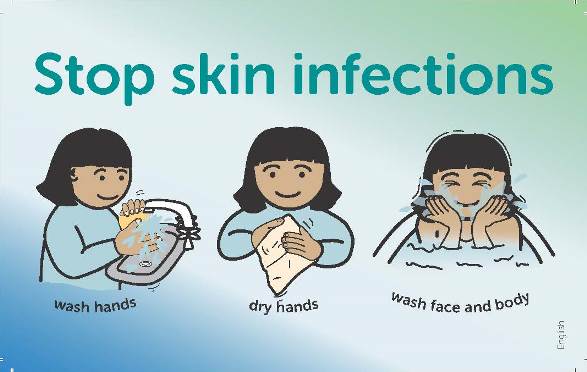 How To Prevent Skin Infections - Mixnew15